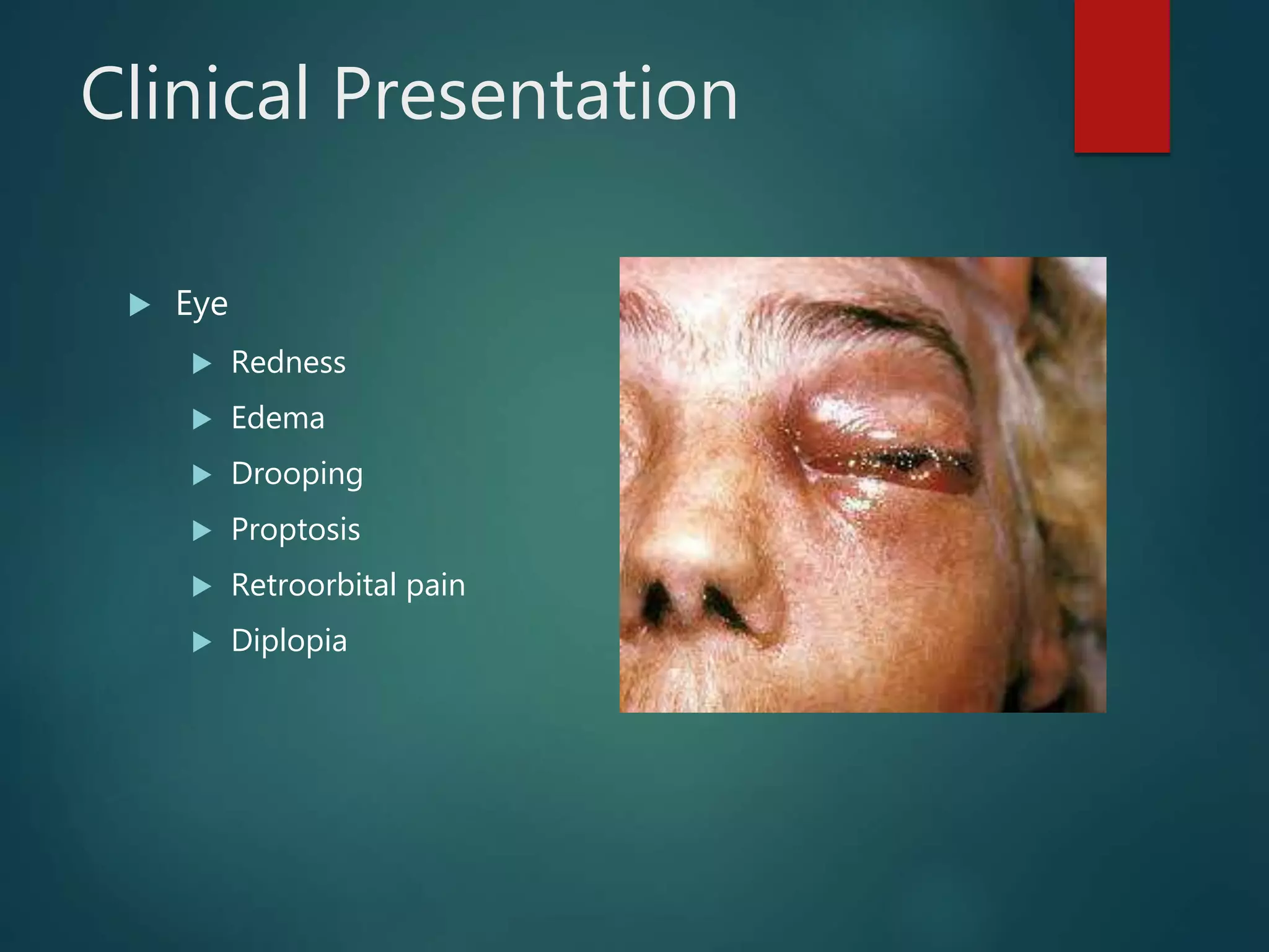 Mucormycosis | PPTX