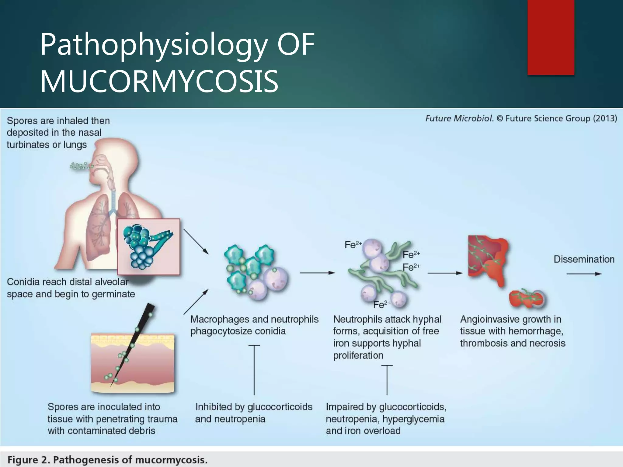 Mucormycosis | PPTX | Lung and Respiratory Health | Diseases and Conditions