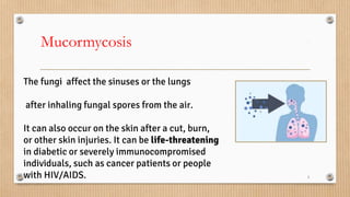 Mucormycosis | PPTX