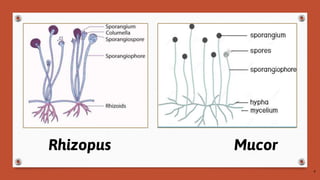 Mucormycosis | PPTX