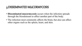 MUCORMYCOSIS.pptx