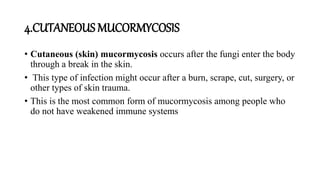 MUCORMYCOSIS.pptx
