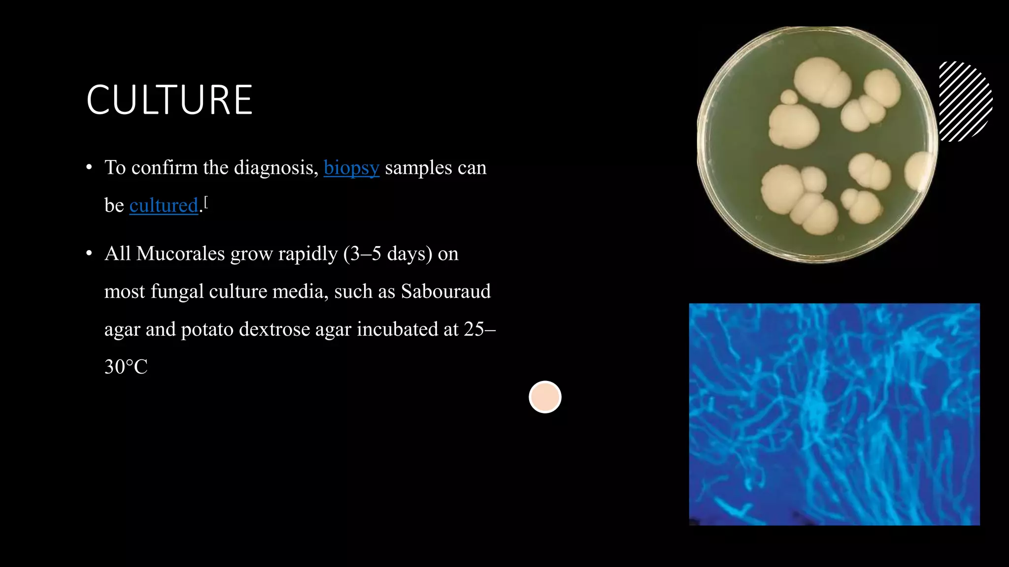 Mucormycosis and its management | PPTX