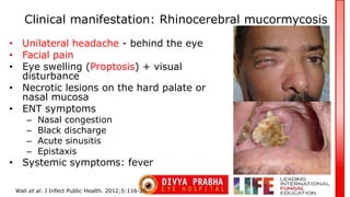 Mucormycosis & The Eye | PPT