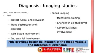 Mucormycosis & The Eye | PPT