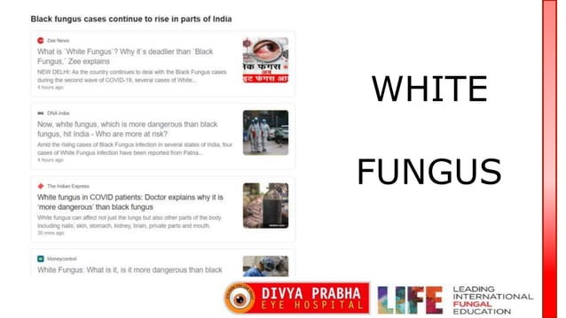 Mucormycosis & The Eye | PPT