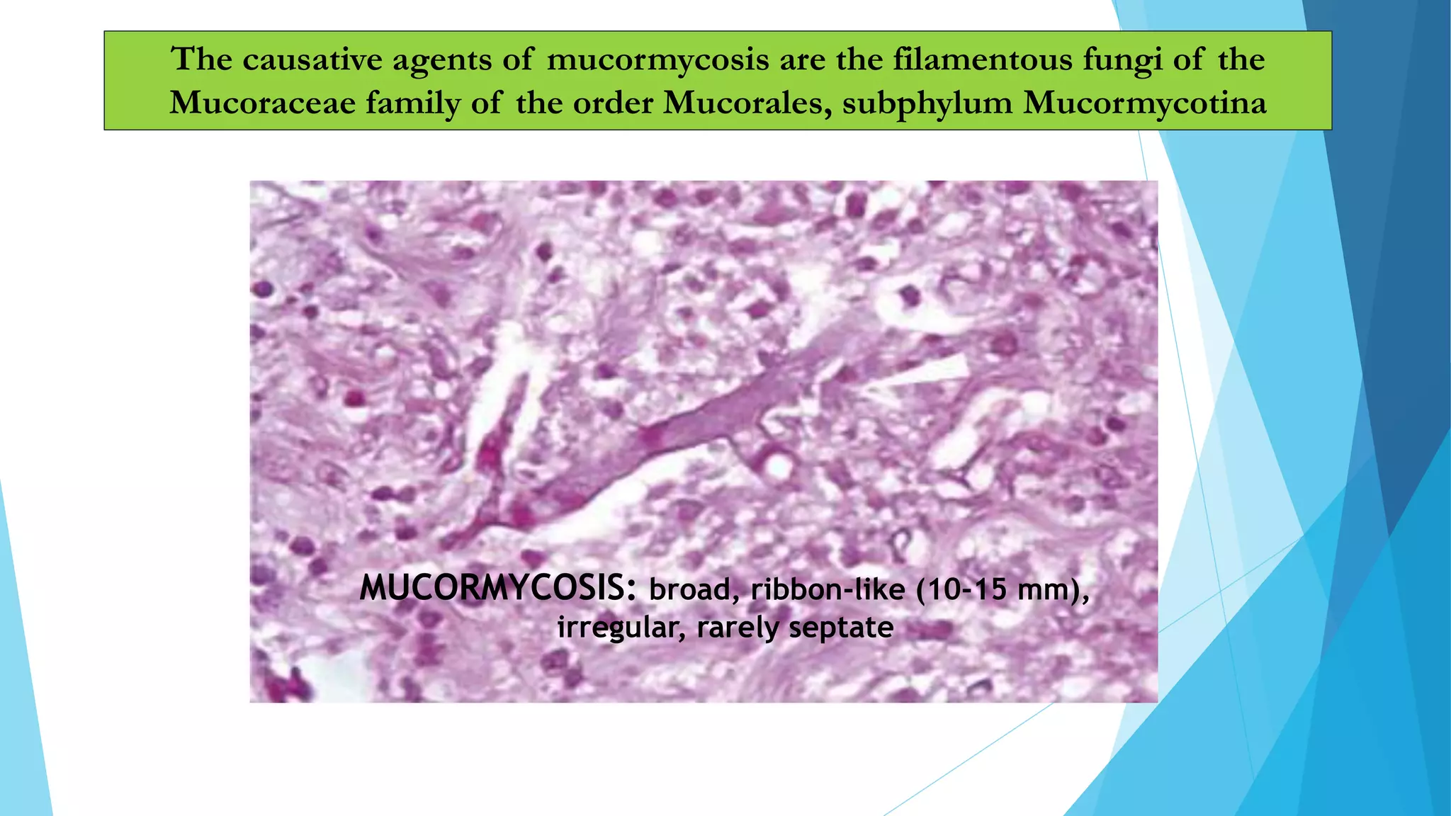 MUCORMYCOSIS NEW.pptx