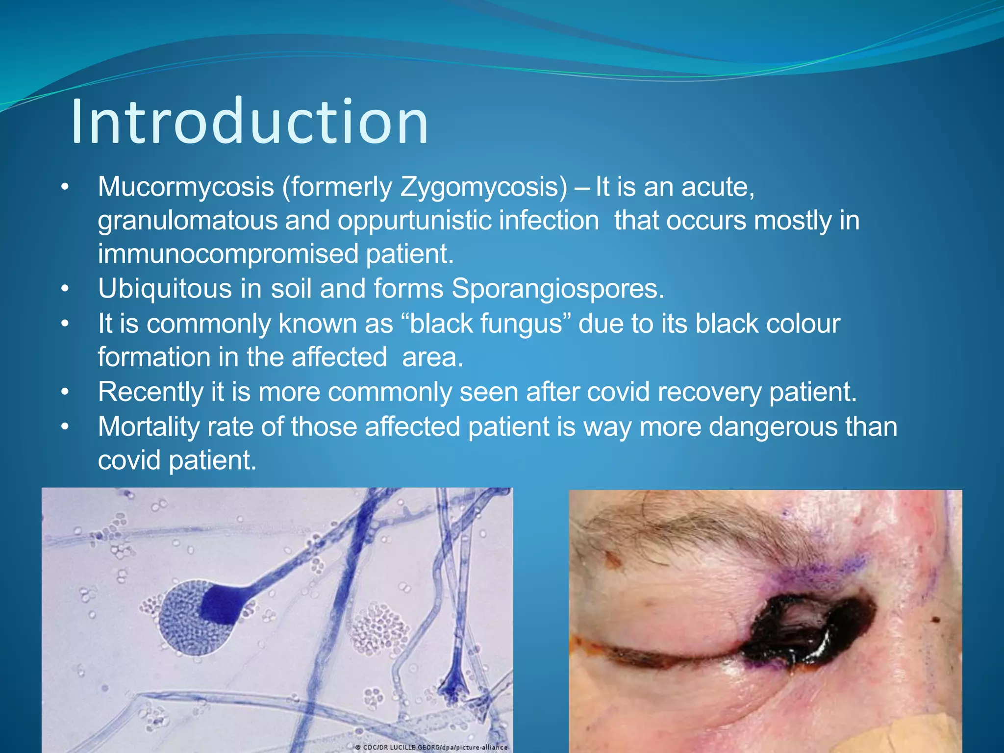 Mucormycosis ppt by Dr. Bomkar bam ENT M.S. | PPTX