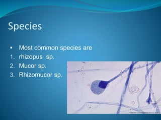Mucormycosis ppt by Dr. Bomkar bam ENT M.S. | PPTX
