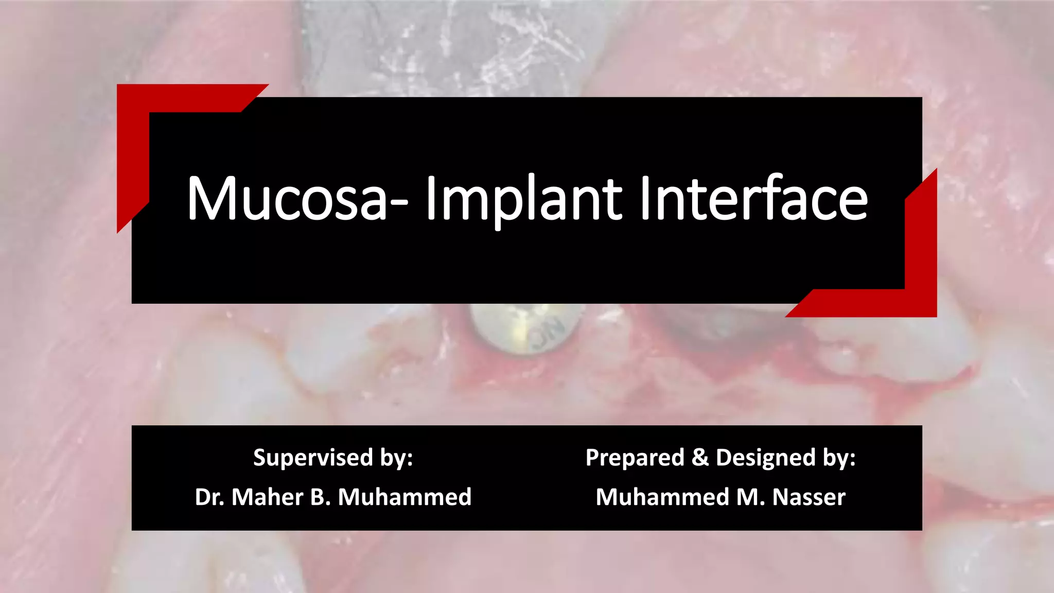 Mucosa- Implant Interface.pptx