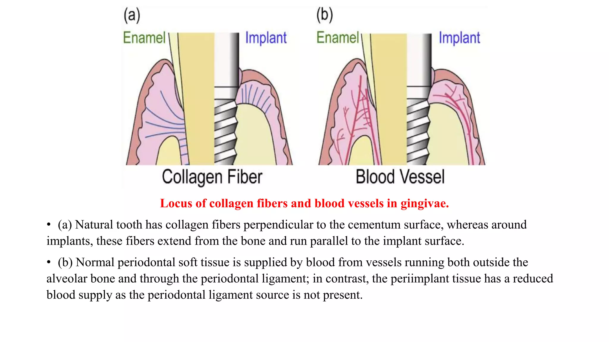 Mucosa- Implant Interface.pptx