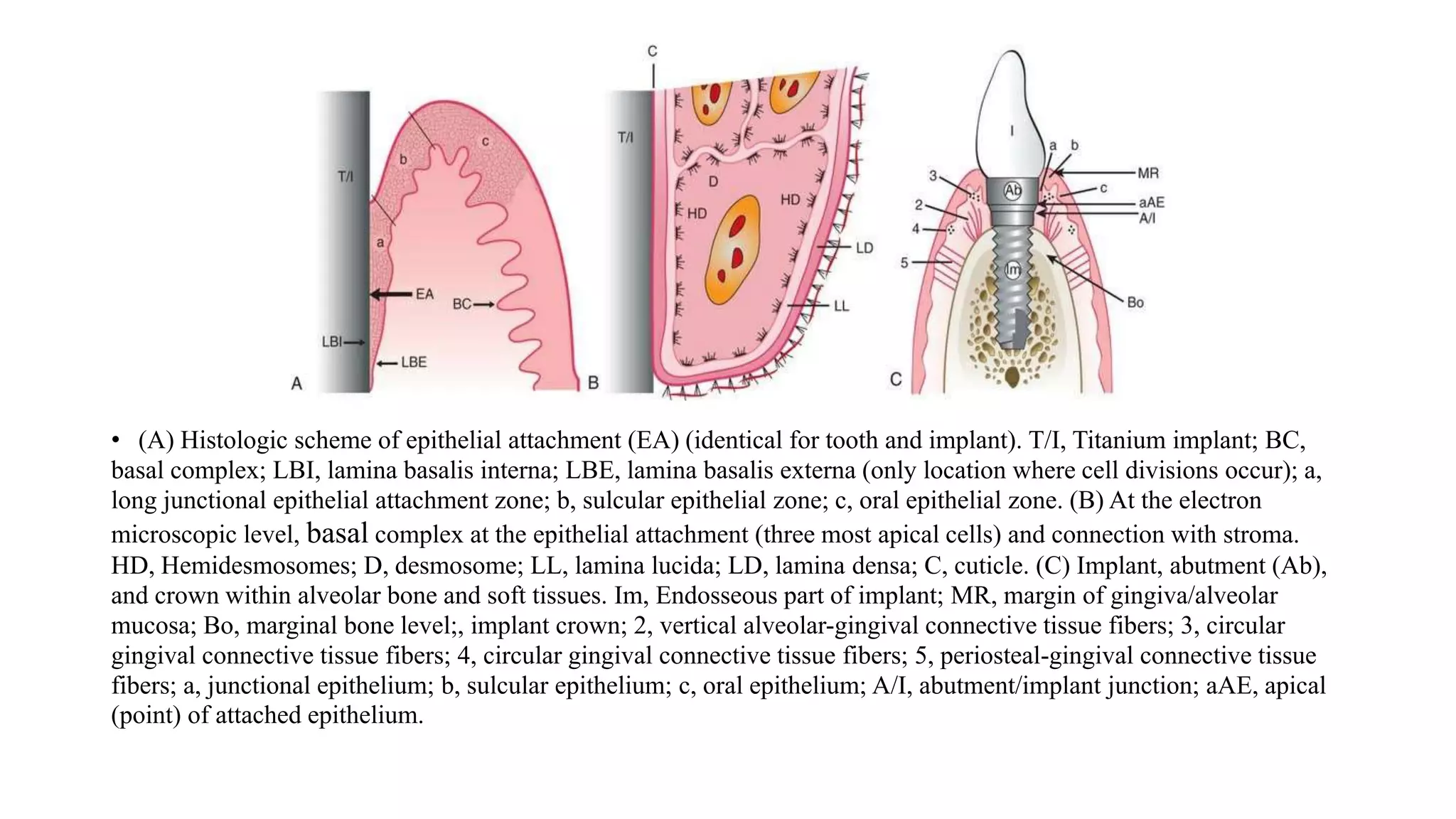 Mucosa- Implant Interface.pptx