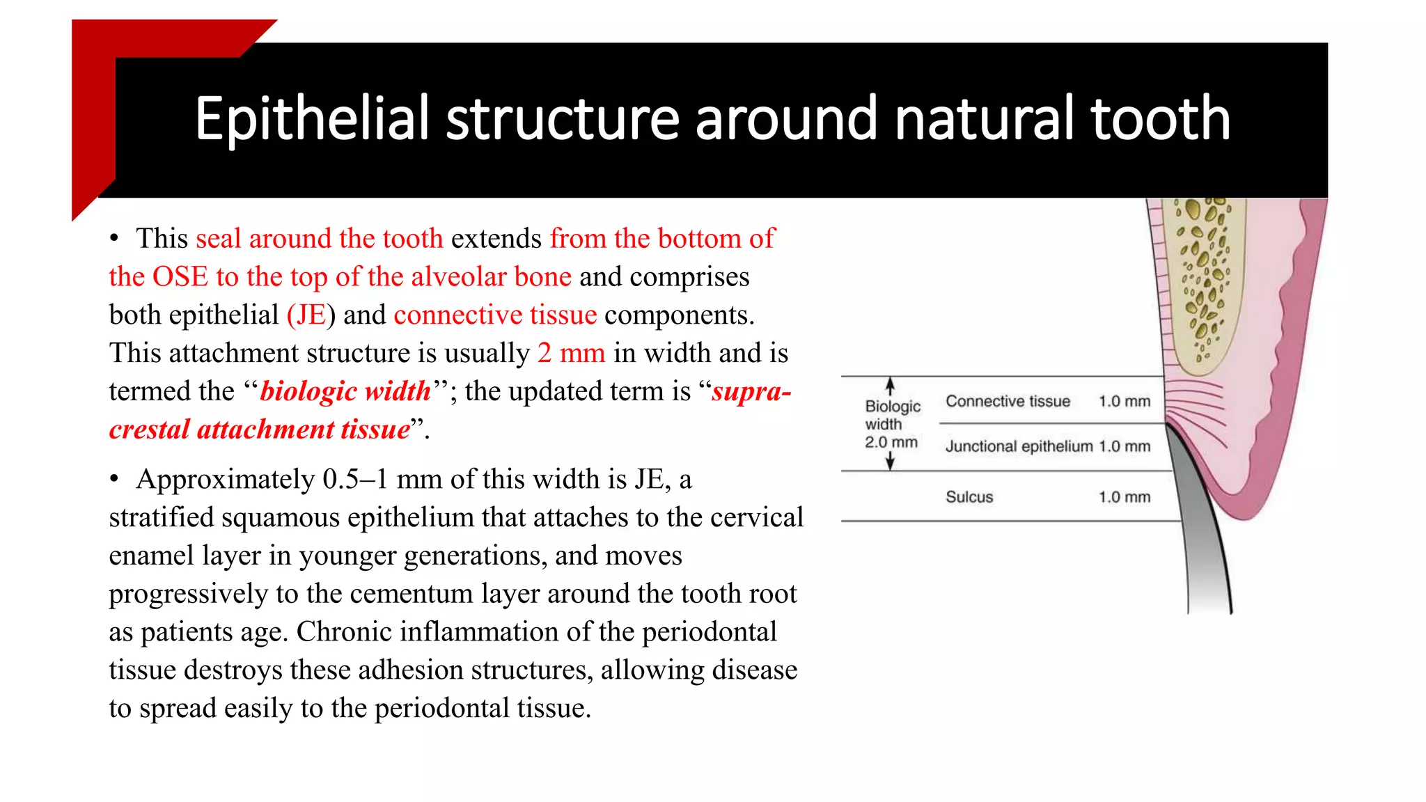 Mucosa- Implant Interface.pptx