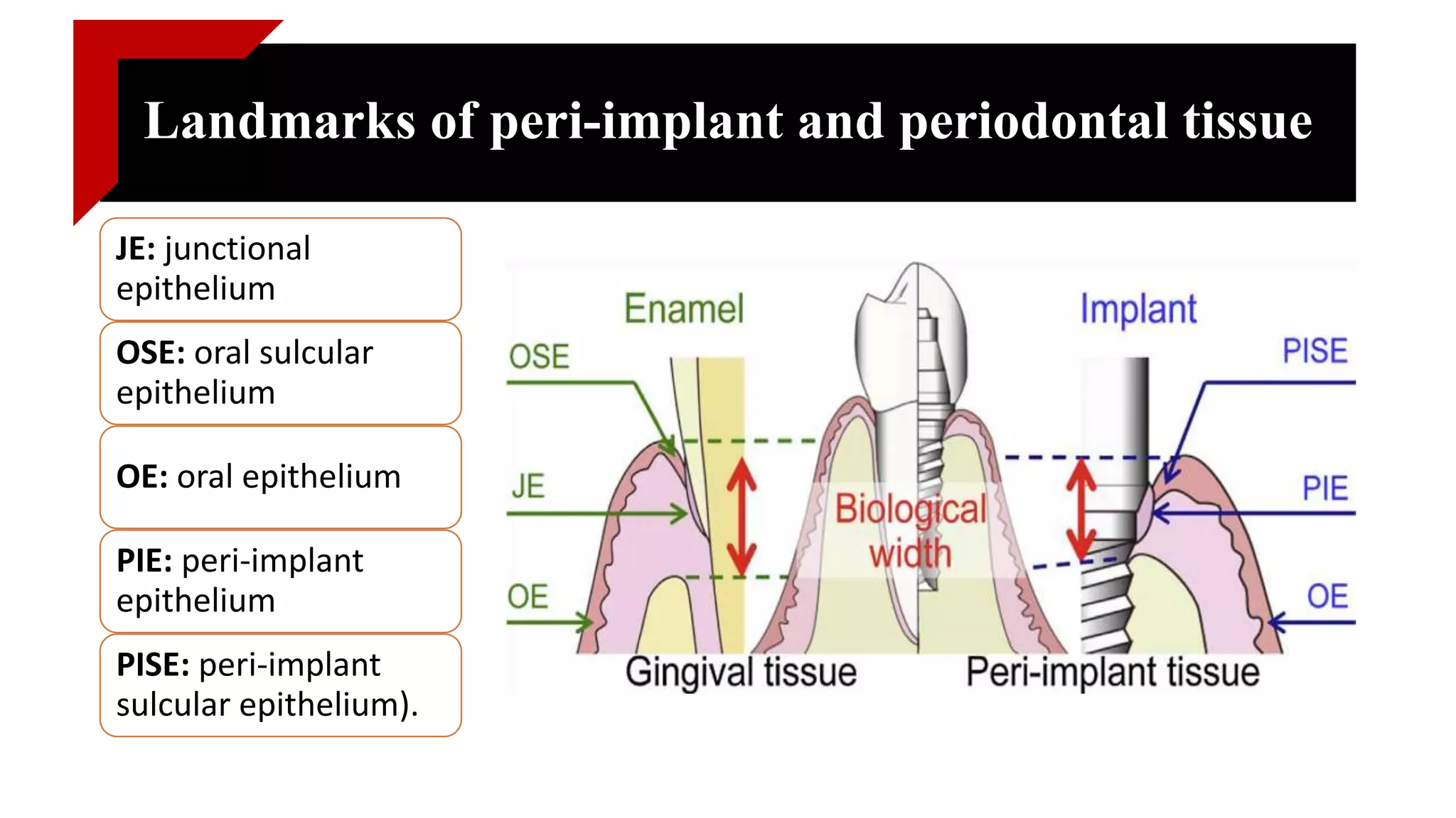 Mucosa- Implant Interface.pptx