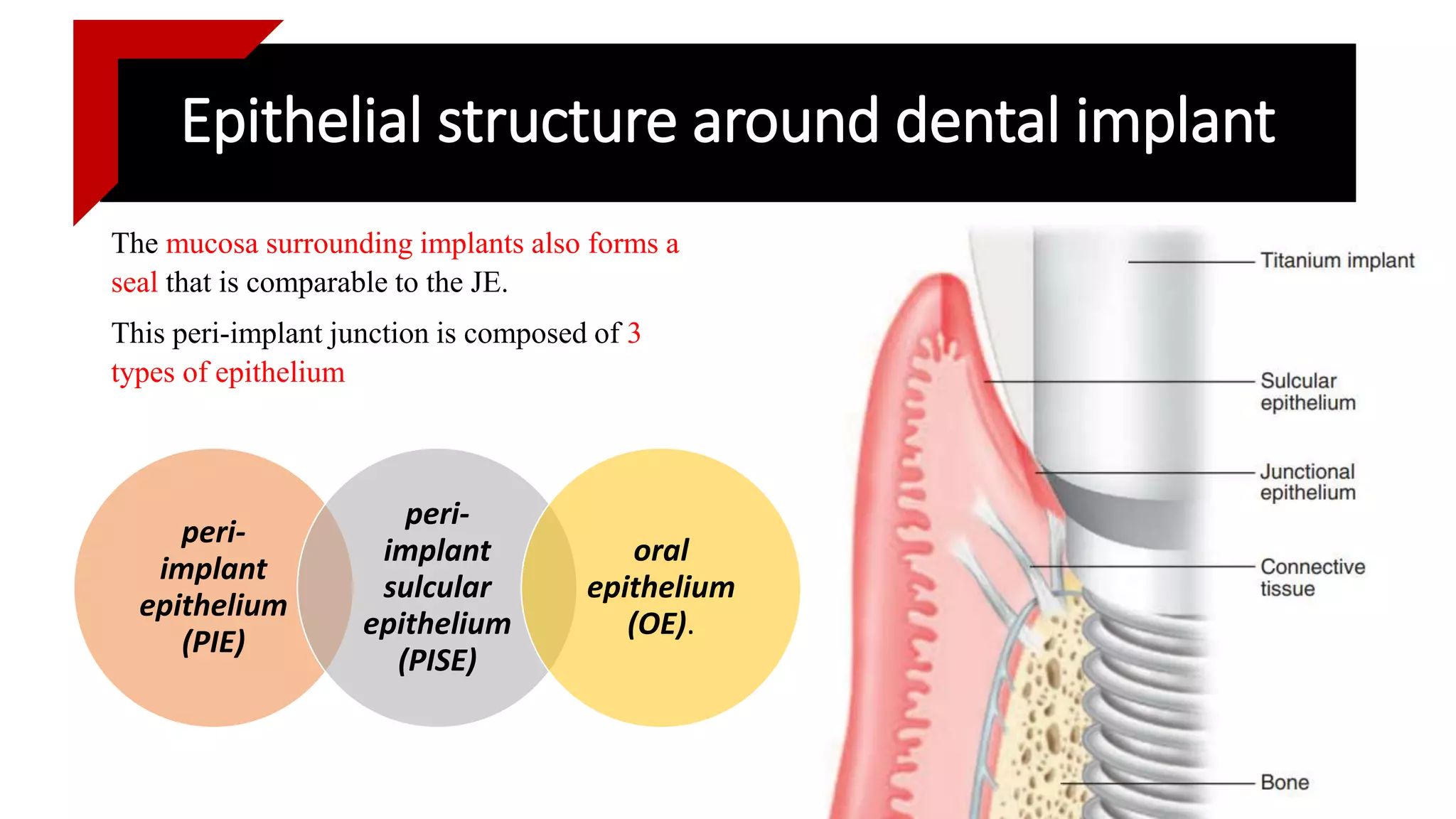 Mucosa- Implant Interface.pptx