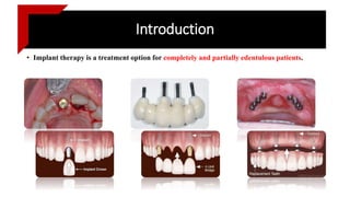 Mucosa- Implant Interface.pptx