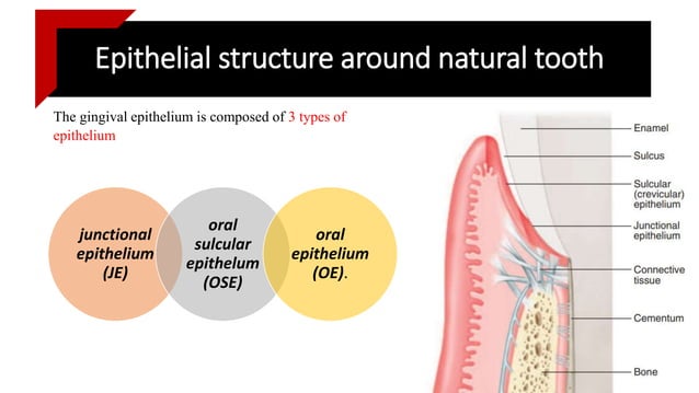Mucosa- Implant Interface.pptx | Dental Health | Diseases and Conditions