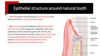 Mucosa- Implant Interface.pptx