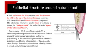 Mucosa- Implant Interface.pptx