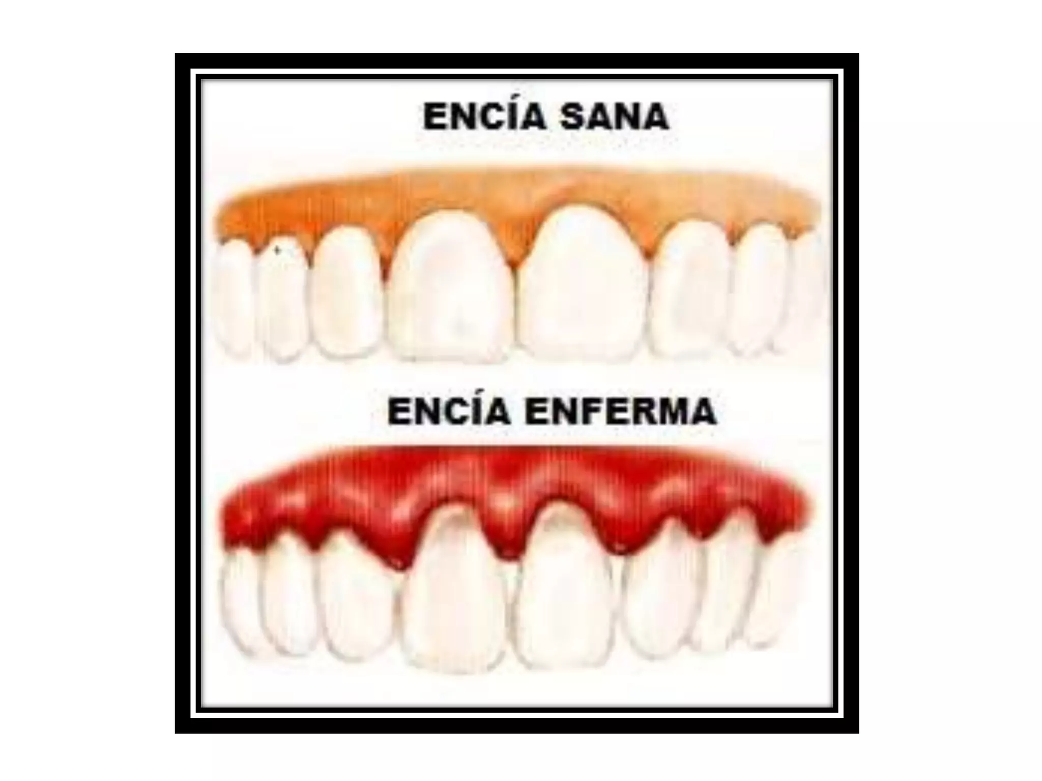 Mucosa bucal | PPTX