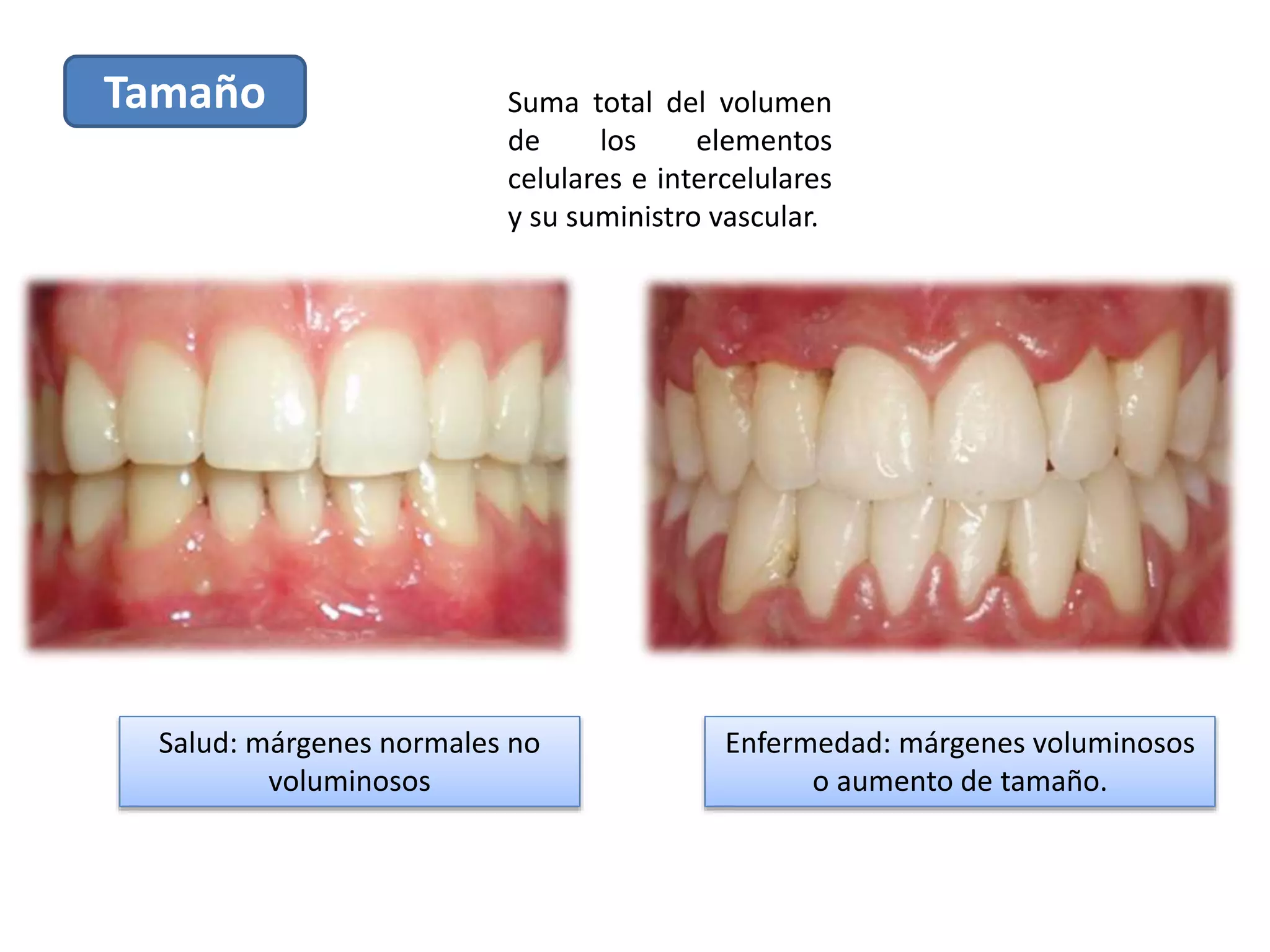 Mucosa bucal | PPTX