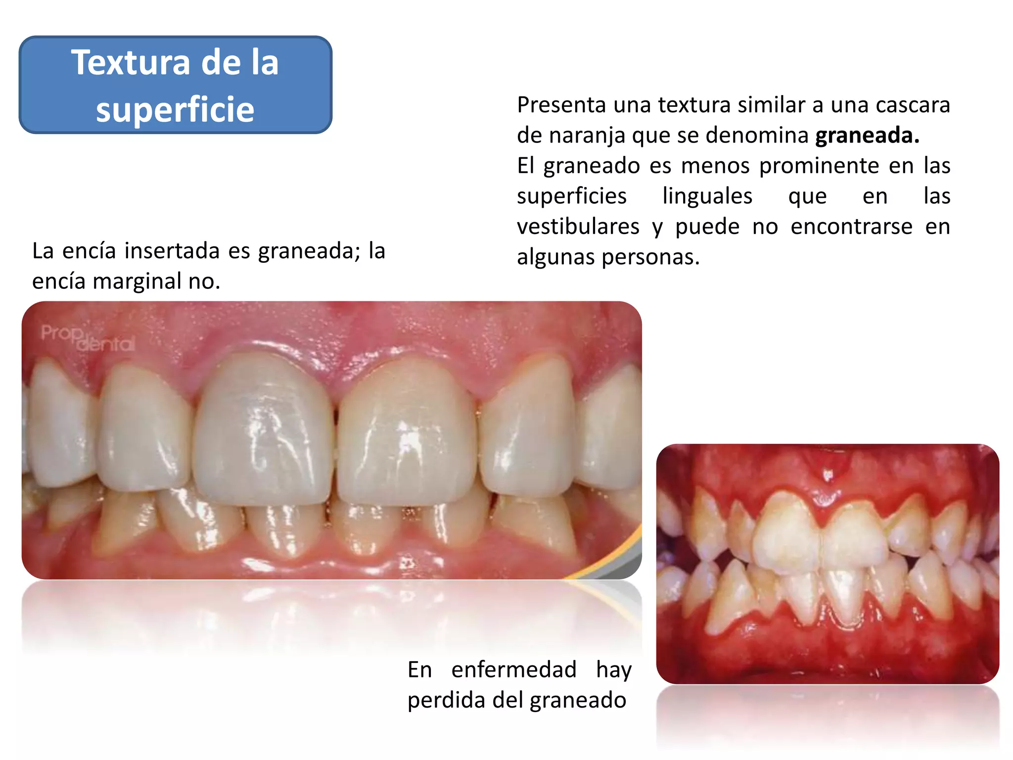 Mucosa bucal | PPTX