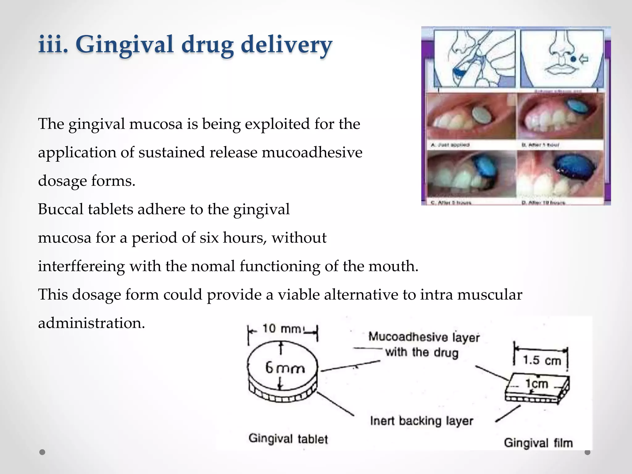Mucosal Drug Delivery System | PPTX