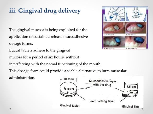 Mucosal Drug Delivery System | PPTX