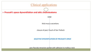 Mucosal folds and ventilation of middle ear | PPTX