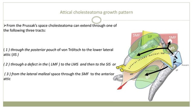 Mucosal folds and ventilation of middle ear | PPTX