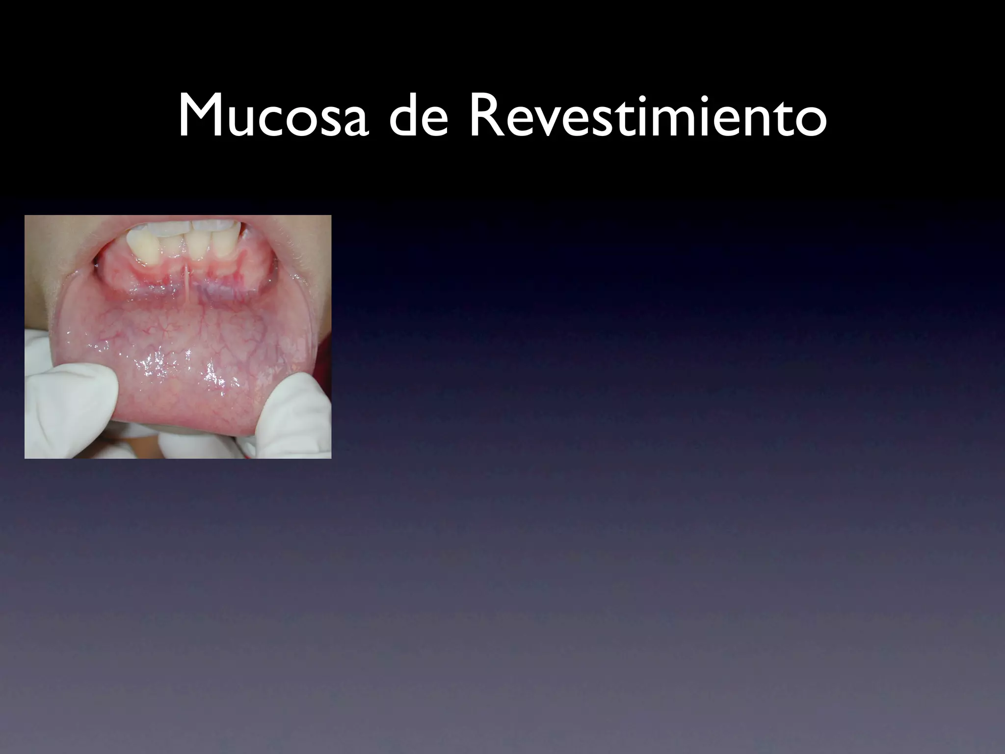 Mucosa oral | KEY