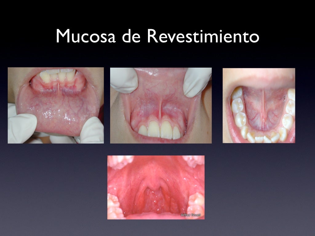 Mucosa oral
