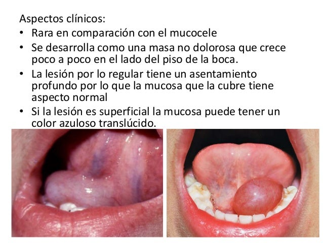 Mucosa oral