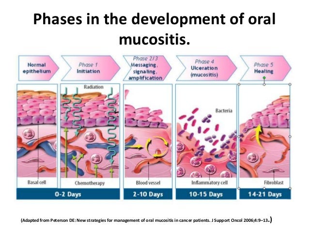Cancer therapy induced Mucositis