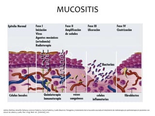 Mucositis secundario a tratamiento de Ca | PPTX
