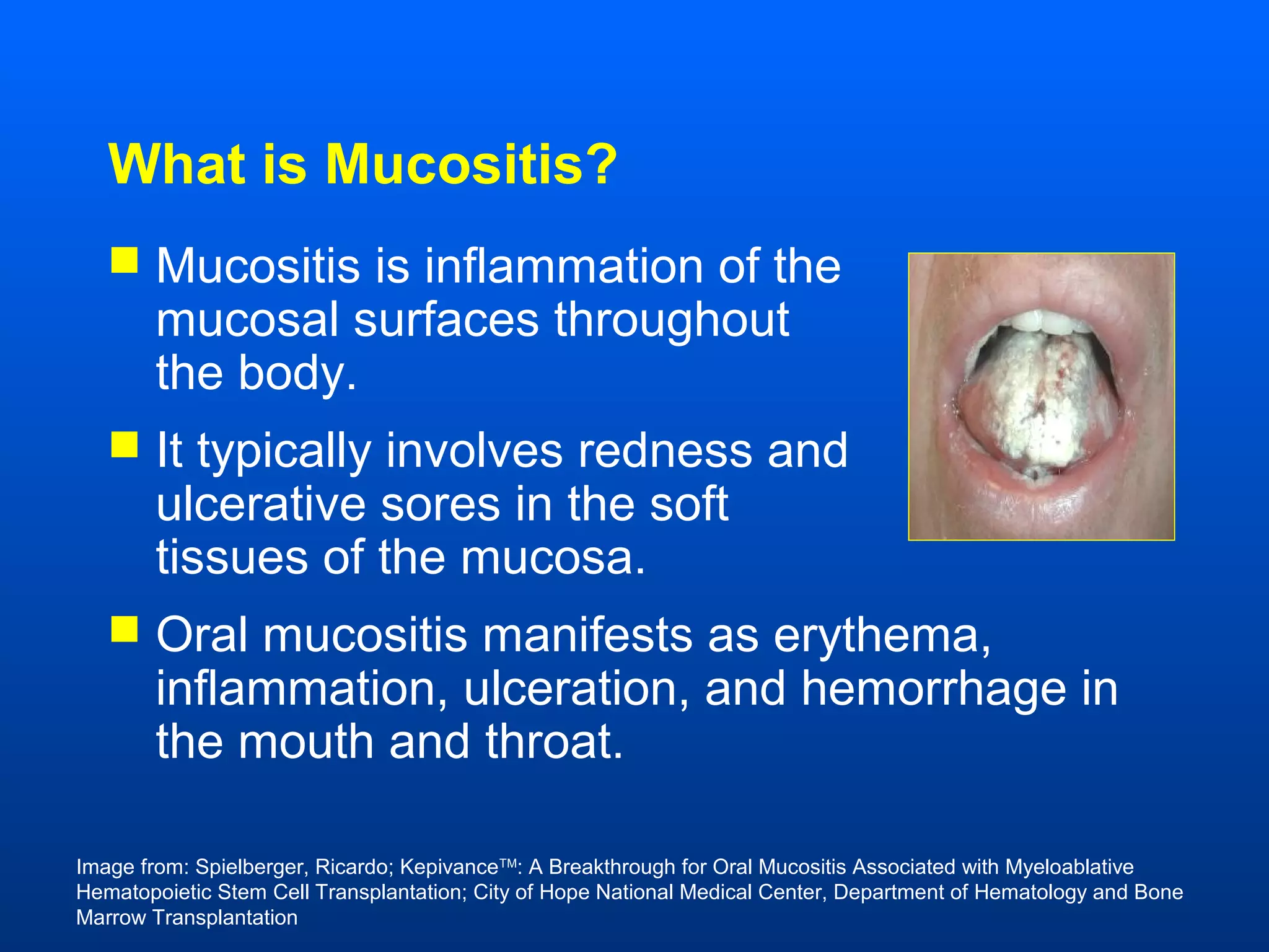 Mucositis oral | PPT