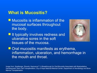 Mucositis oral | PPT