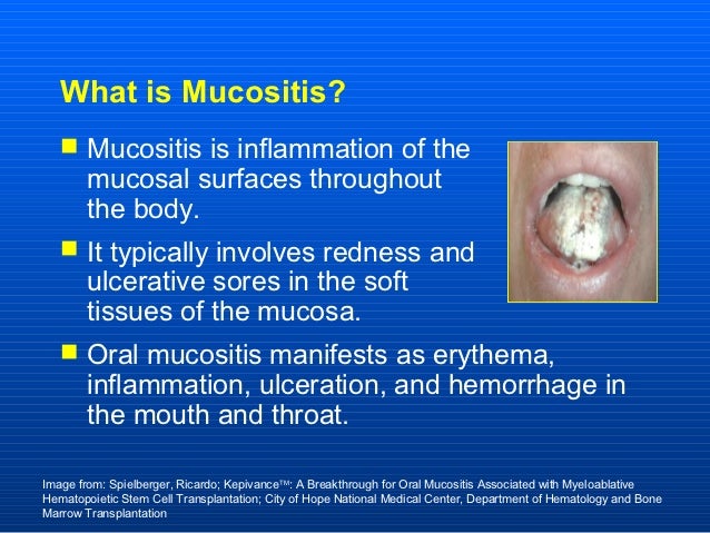 Mucositis oral