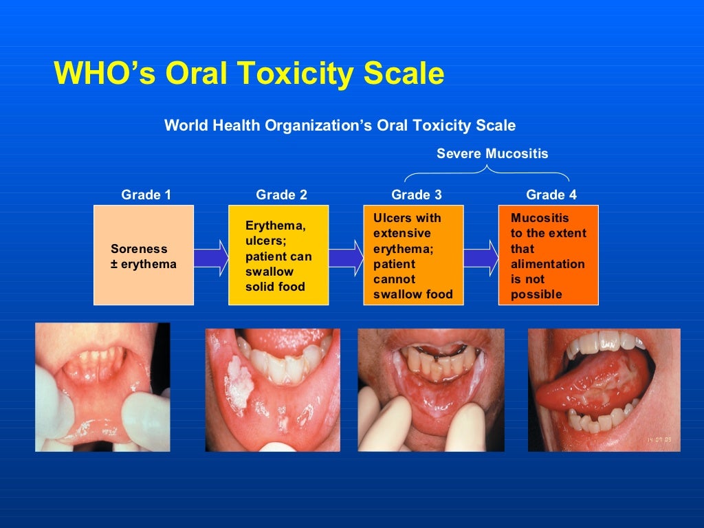 Mucositis oral