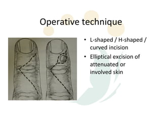 Mucous cysts-dipjw | PPT