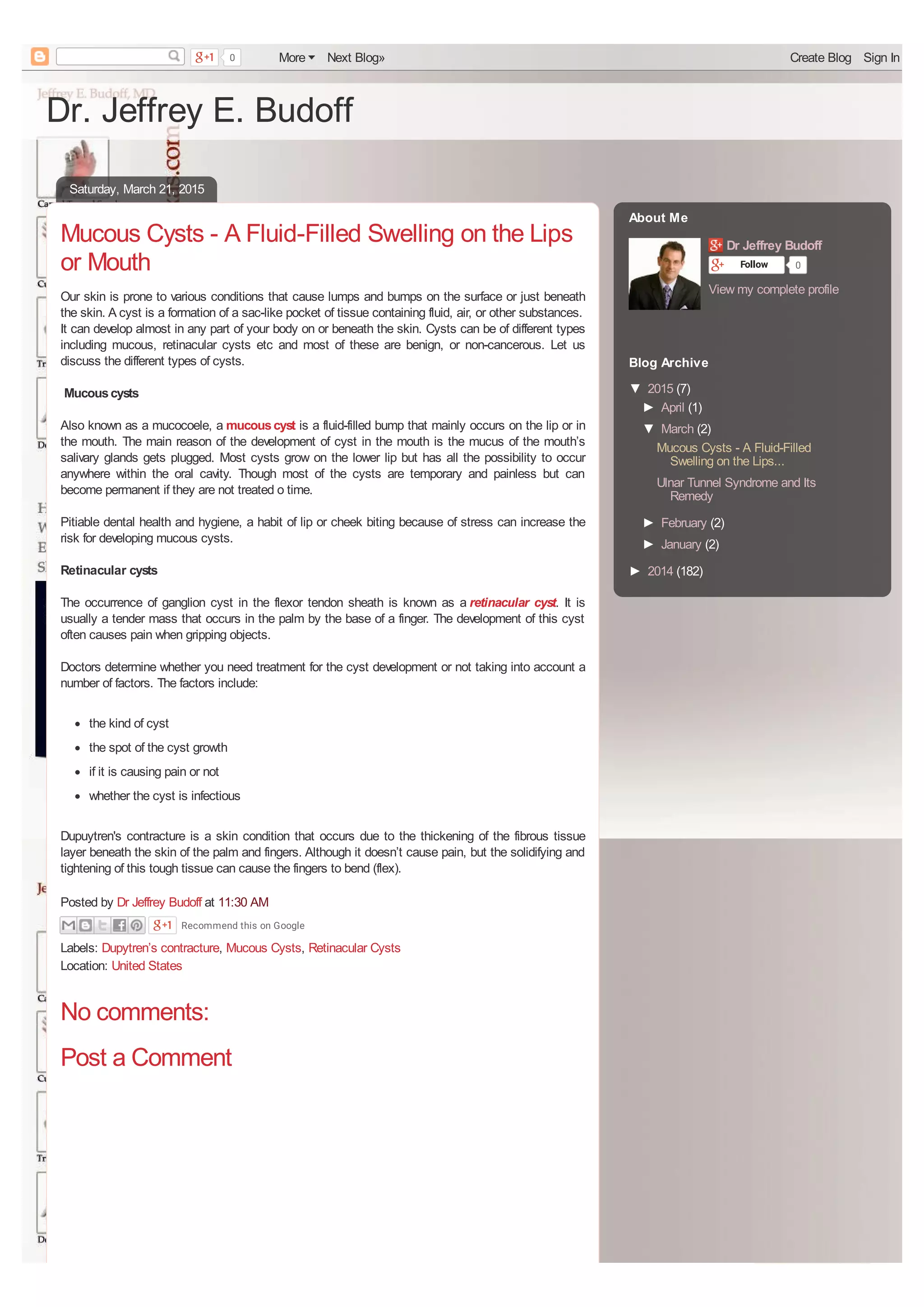 Mucous Cysts - A Fluid-Filled Swelling on the Lips or Mouth | PDF