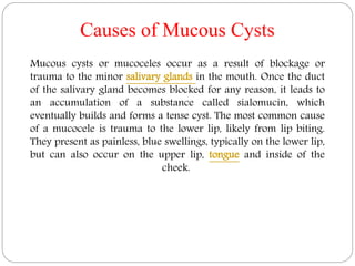 Mucous cysts (Mucoceles): Symptoms, causes, treatment and preventions ...