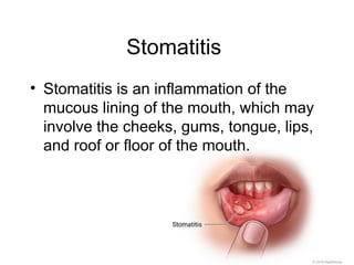 mucous membrane disorders for nurses 1.ppt