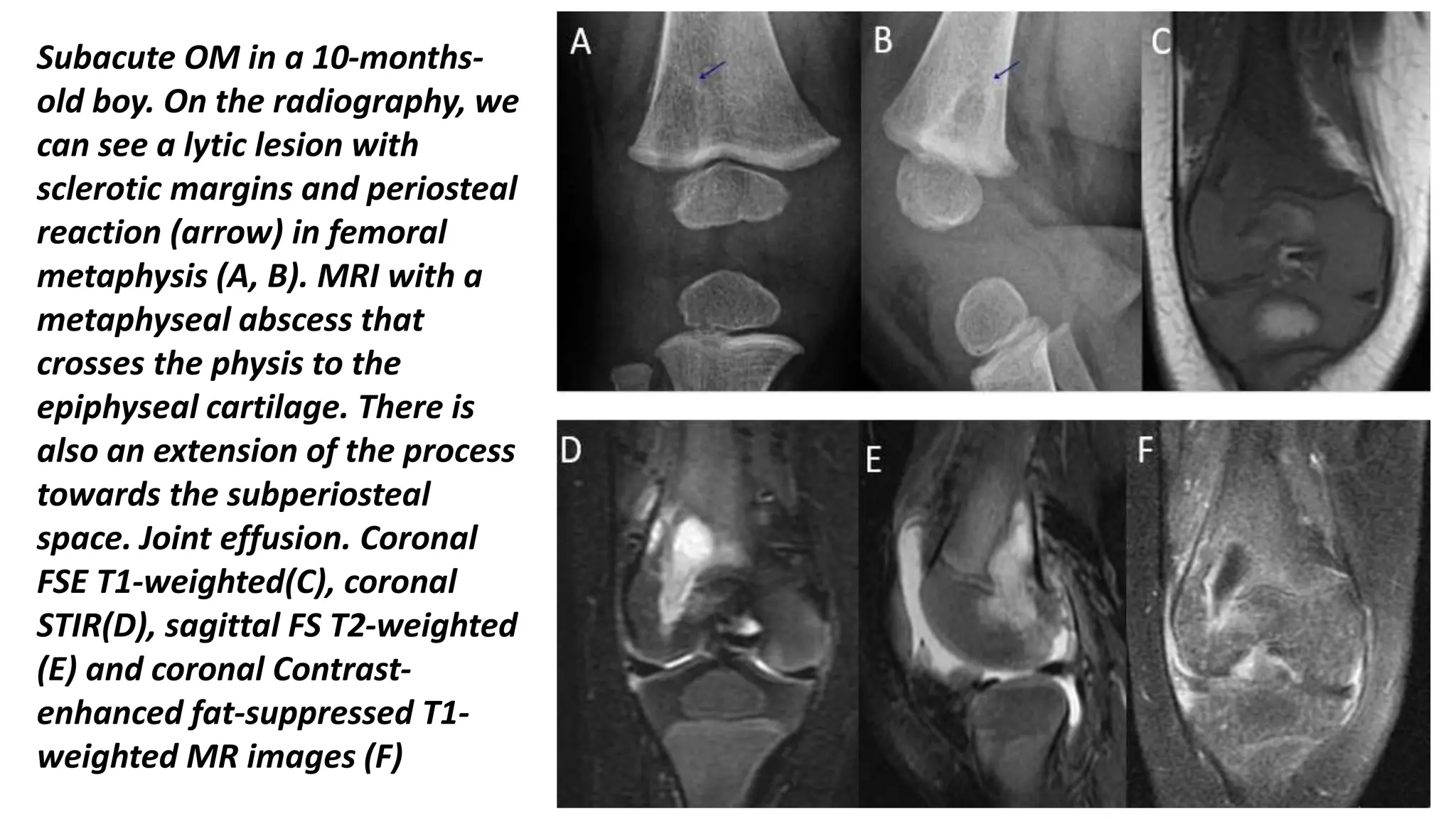 Muculoskeletal Pediatic Imaging..pptx