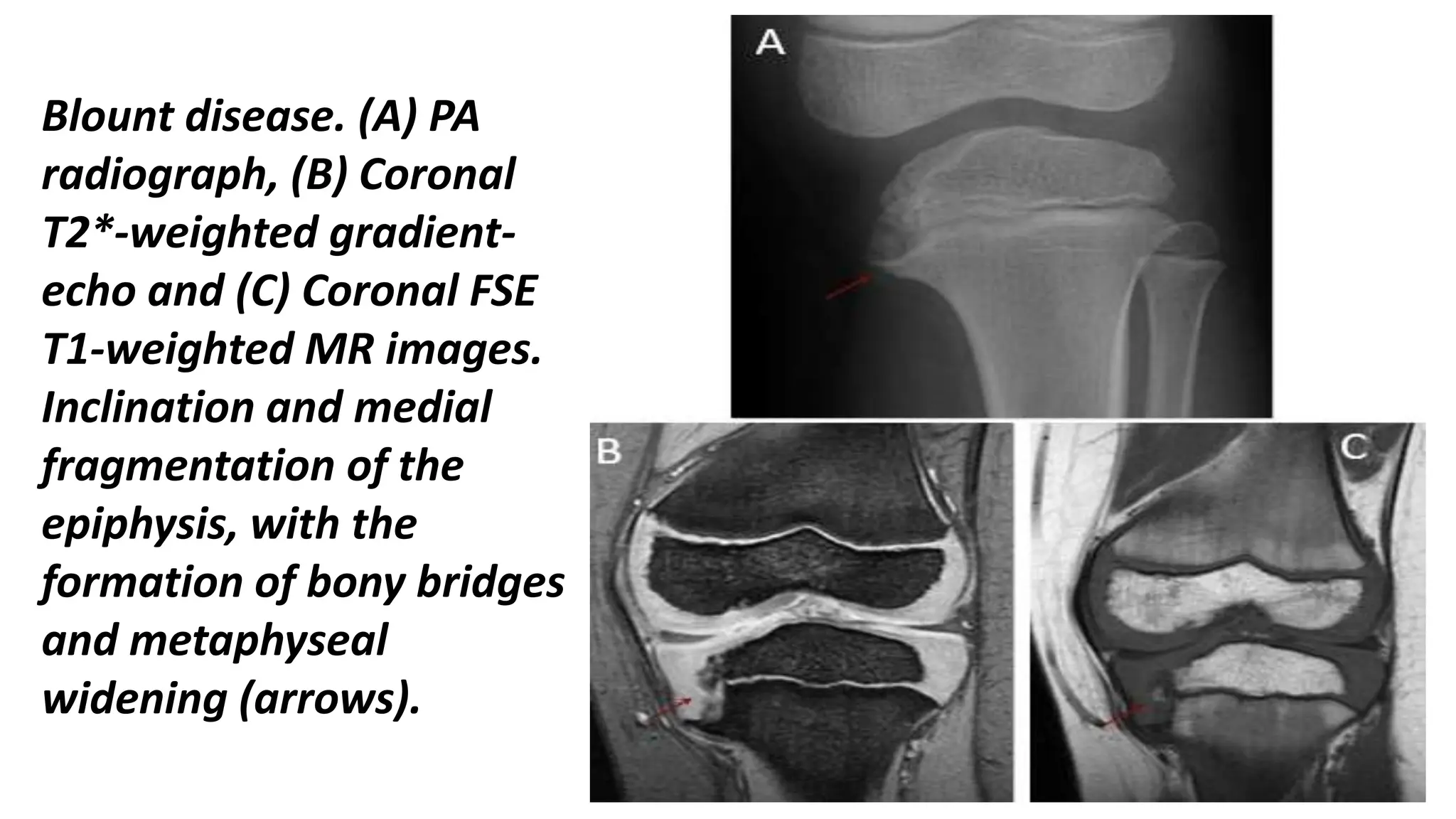 Muculoskeletal Pediatic Imaging..pptx