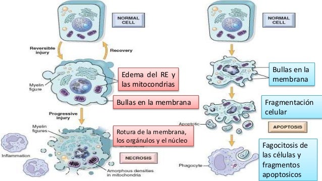 Patología-Muerte Celular