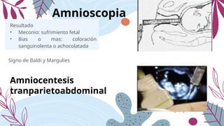 ginecooooooooobstetricia. MUERTE FETAL.pptx