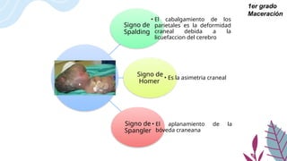 ginecooooooooobstetricia. MUERTE FETAL.pptx