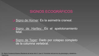 MUERTE FETAL INTRAUTERINA.pptx