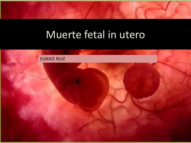 Muerte fetal in utero